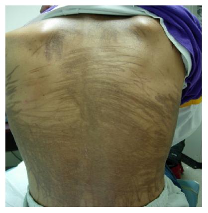Home | Litt's Drug Eruption and Reaction Database